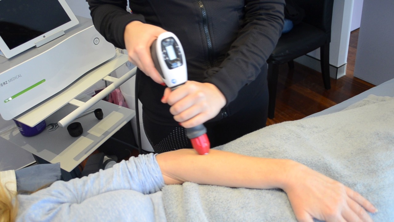 One of our physio using Shockwave Therapy on elbow - YouTube