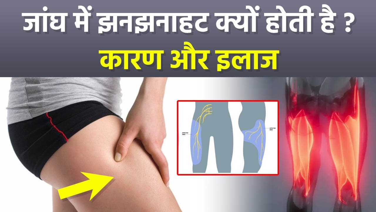 Meralgia Paresthetica Causes & Treatment: Thigh Me Jhanjhanahat Reason ...