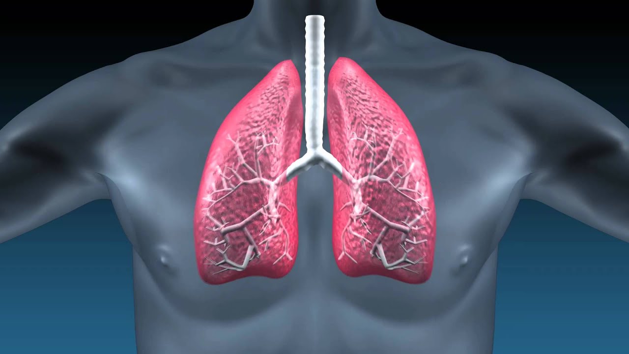 Pulmonary Fibrosis - YouTube