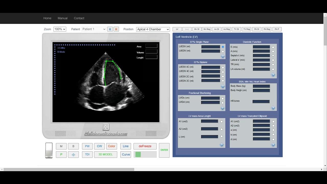 Volumetric measurements In Echocardiography - YouTube
