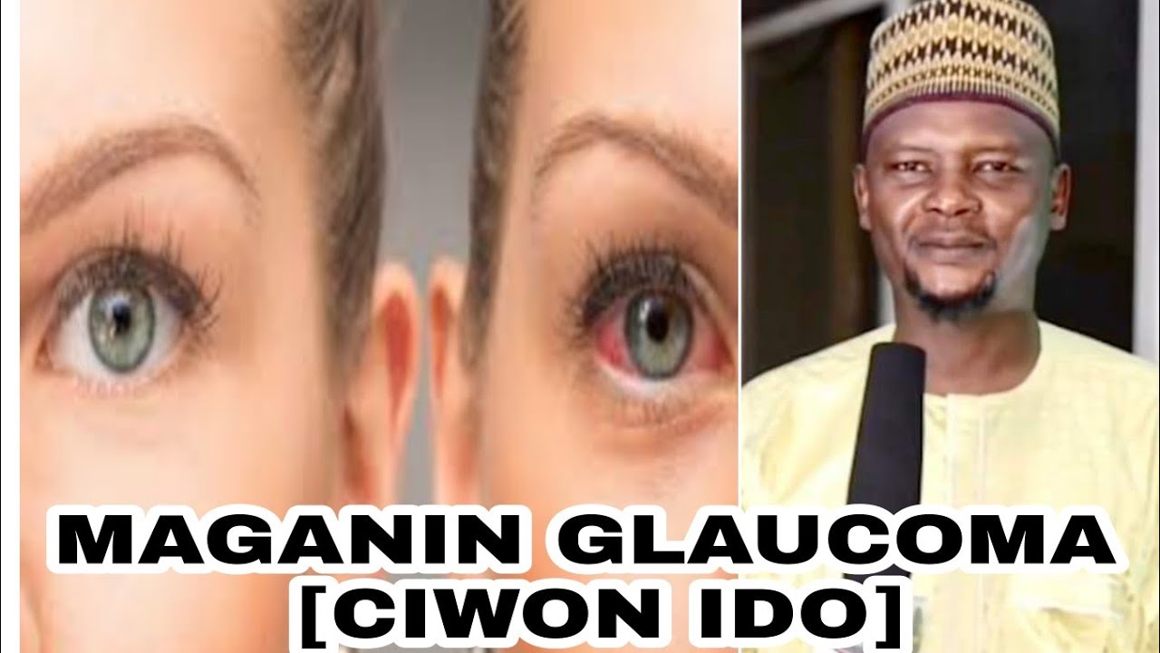 MAGANIN GLAUCOMA [CIWON IDO] DR. ABDULWAHAB ABUBAKAR GONI BAUCHI ...