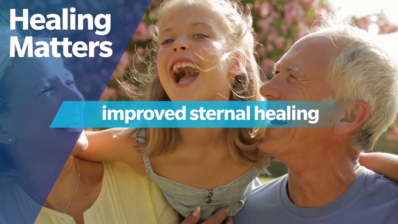 Sternal Closure | SternaLock Blu: The Method Matters - YouTube