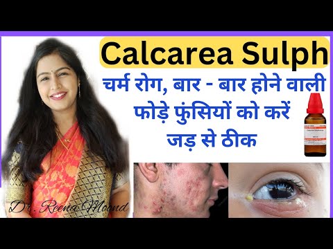 चर्म रोग, बार–बार होने वाले फोड़े फुंसियों को करें जड़ से ठीक, Calcarea ...