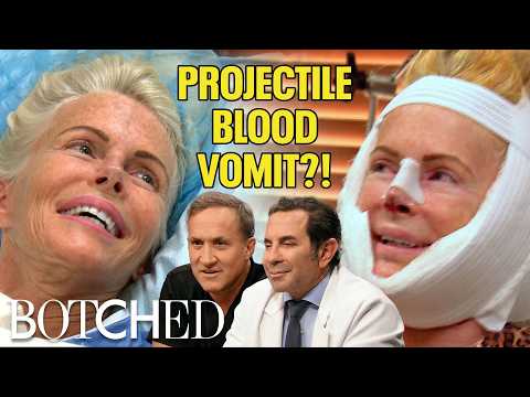 Kathy Vomited Blood After She Was Abandoned in Ecuador For Nose Job (Before & After) | Botched | E!