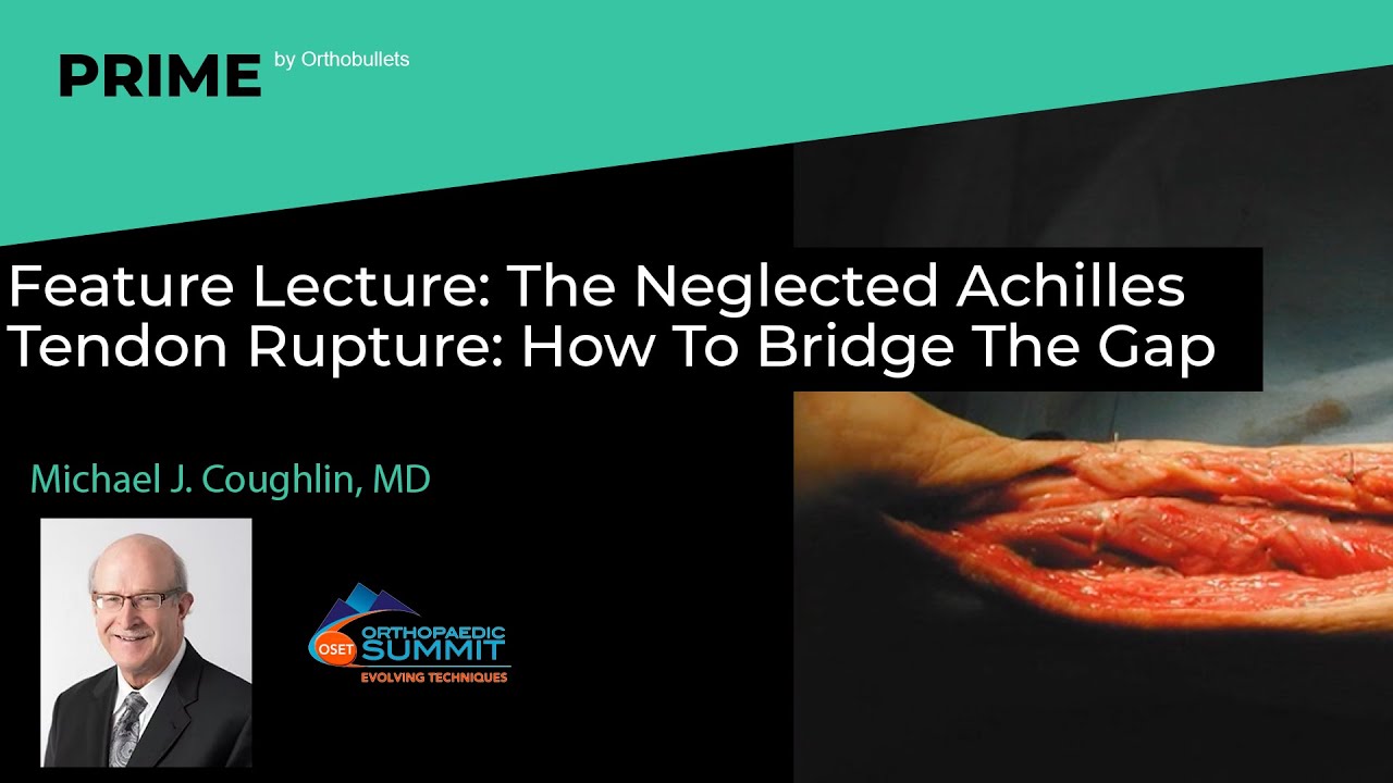 The Neglected Achilles Tendon Rupture: How To Bridge The Gap - Michael ...