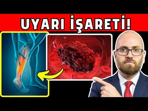 Bacaktaki Bu Belirti ÖLÜMCÜL Olabilir — ve Çoğu Kişi Fark Etmez | Trombozun Gizli Sinyalleri