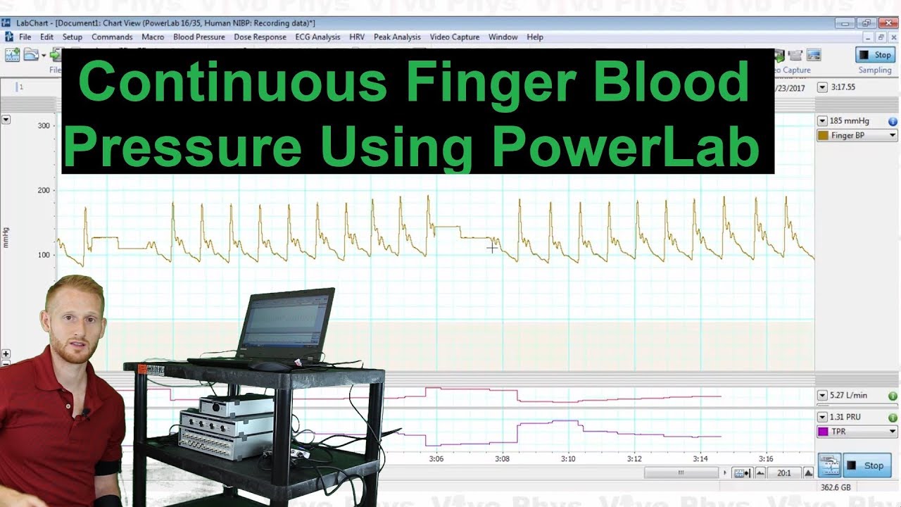 Continuous Finger Blood Pressure in PowerLab - YouTube