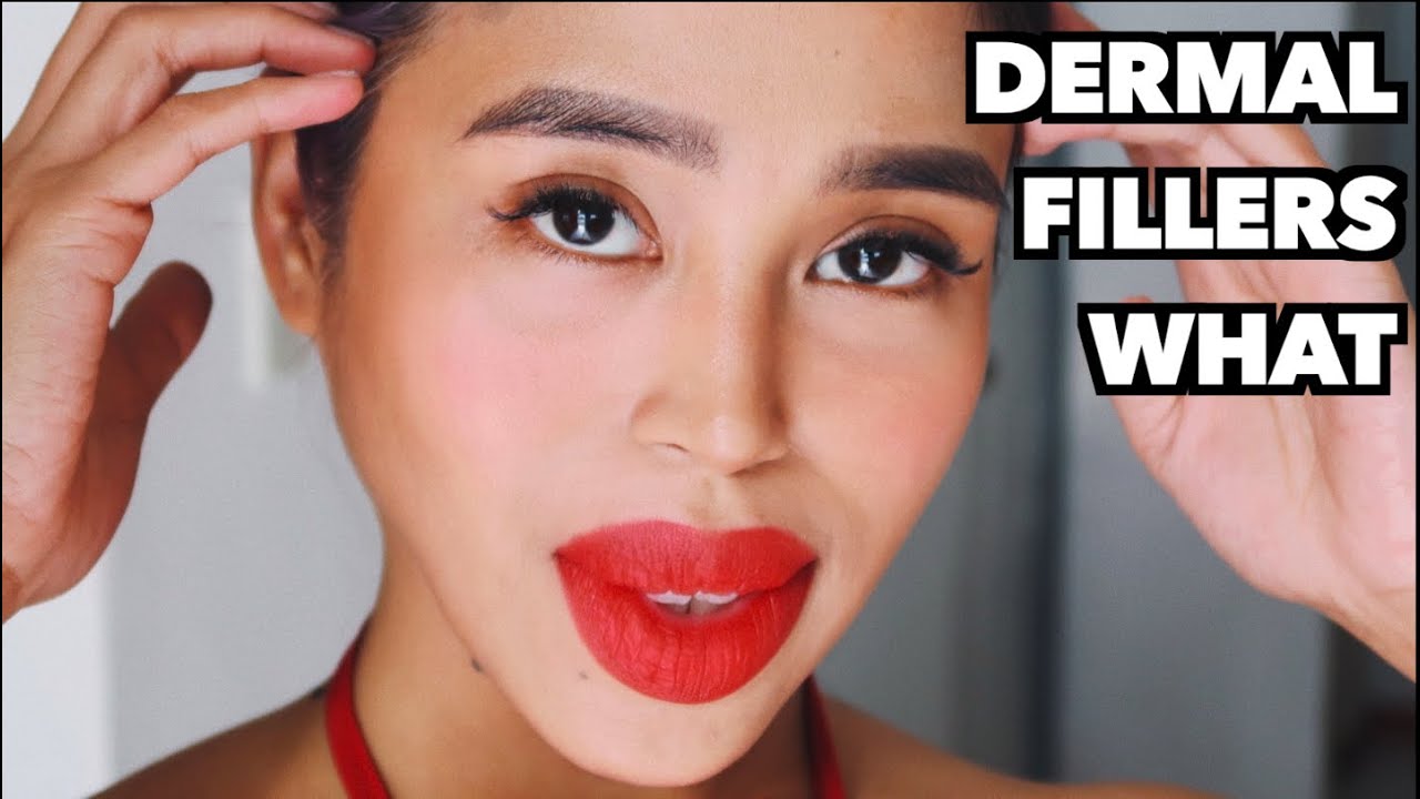 I TRIED DERMAL (LIP AND FACE) FILLERS ft Restylane and Doc Gaile ...
