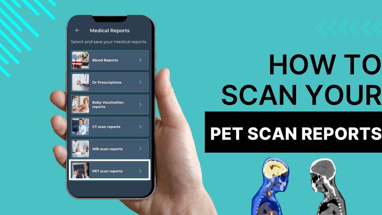 How to Scan and Store PET Scan Reports in Medugo App? - YouTube