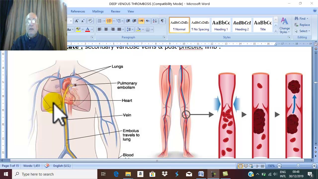 Venous Disorders in English 3 ( Deep venous thrombosis , pathology ...