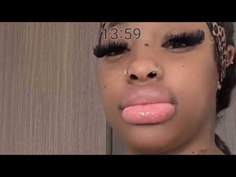 #IVANY LIP 💋 SWELL LIKE 10 POUND A LIVER 😂😂😂😂😂😂 - YouTube