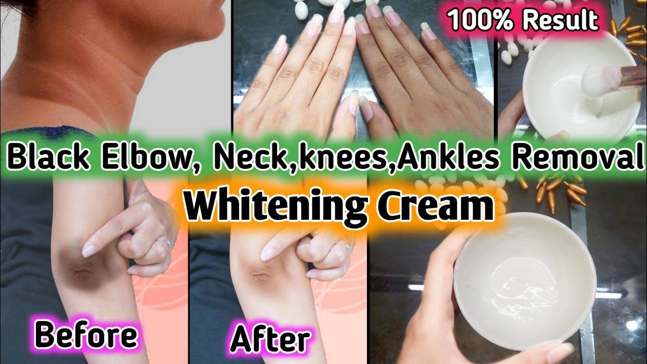 Whitening Cream Formula 100% Effective-Clean Dark Elbow,Neck,Hand,Feet ...
