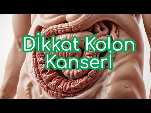 Kolon Kanseri Uyarı İşaretleri! - Prof. Dr. Feryal İlkova