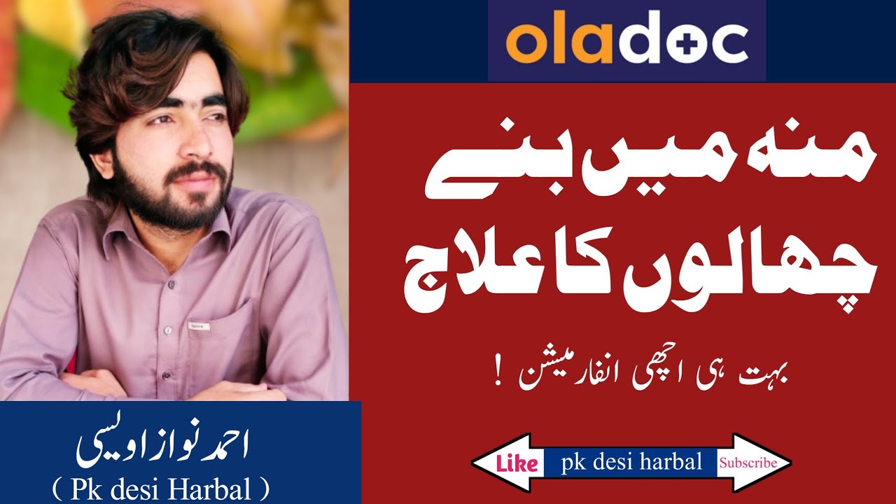 Muh me Chale Ka ilaj In Urdu/Hindi | Muh me Chale Kyun Hote Hain - YouTube