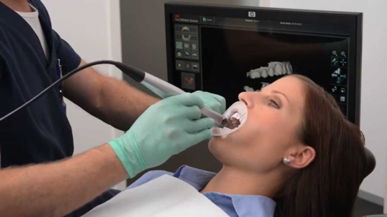 Nuevo escáner 3M True Definition Tutorial paso a paso - YouTube