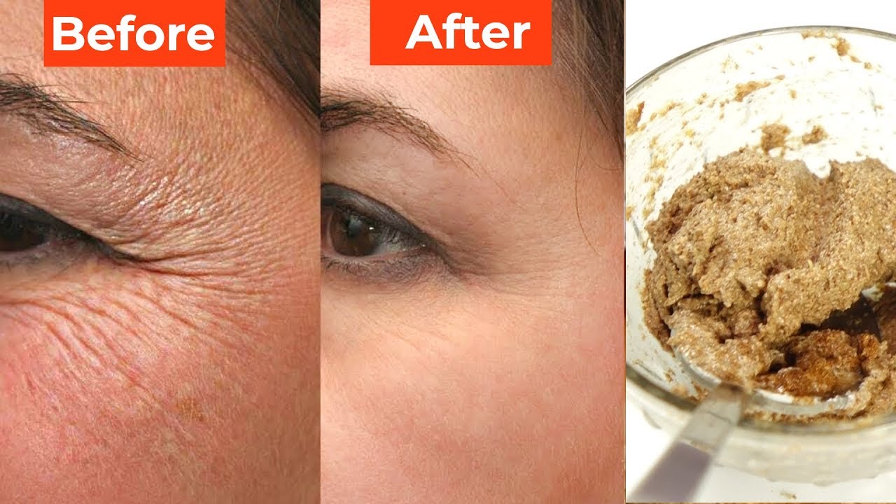 How To Remove Wrinkles From Face and Forehead? Anti Aging Home Remedy ...