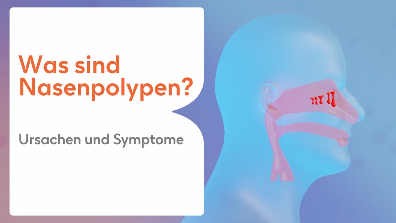Was sind Nasenpolypen? - YouTube
