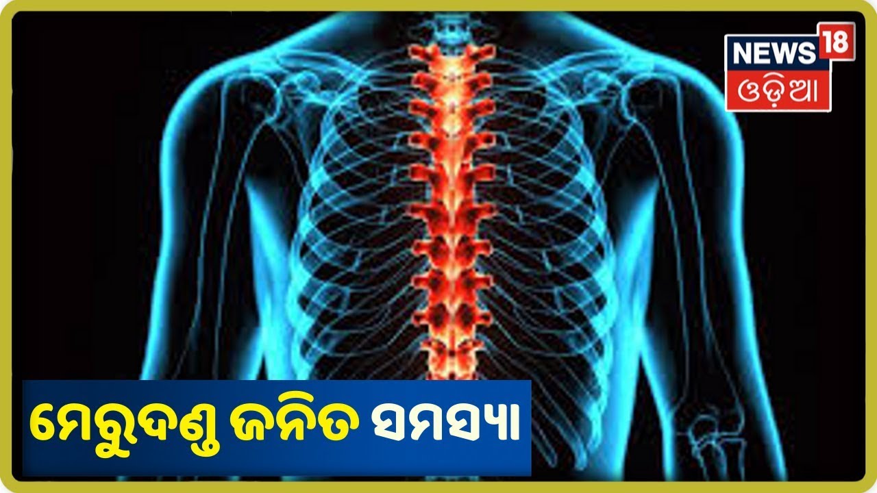 My Doctor LIVE: ମେରୁଦଣ୍ଡ ଜନିତ ସମସ୍ୟା ଓ ପ୍ରତିକାର | News18 Odia(15/09 ...