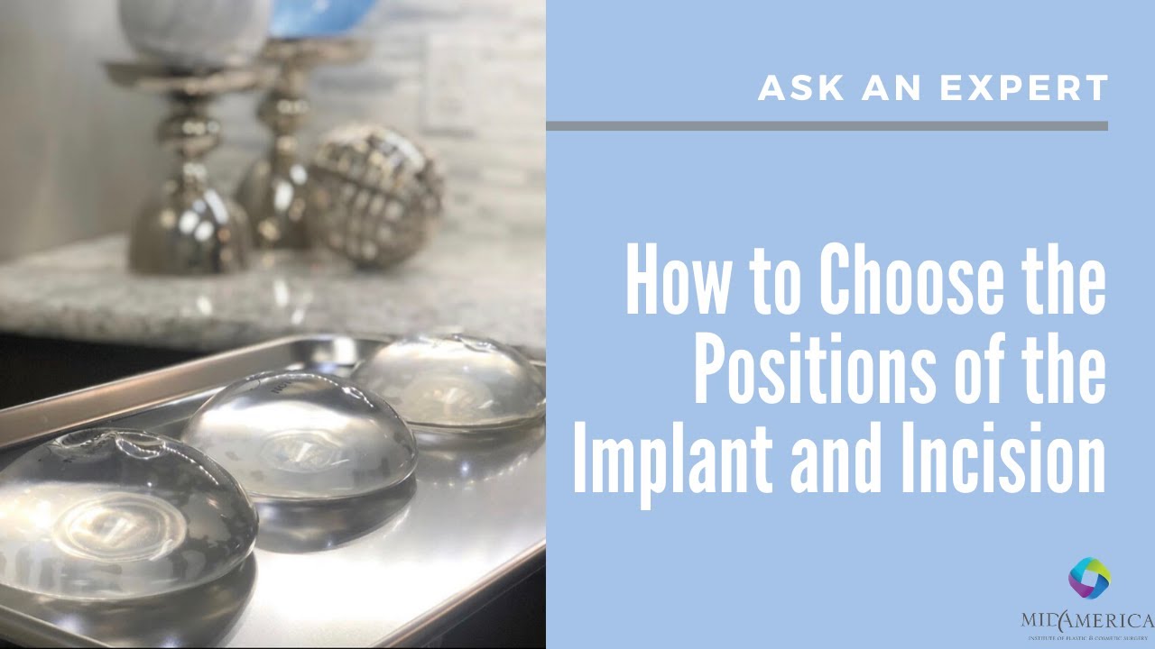 How to Choose the Positions of the Implant and Incision - YouTube