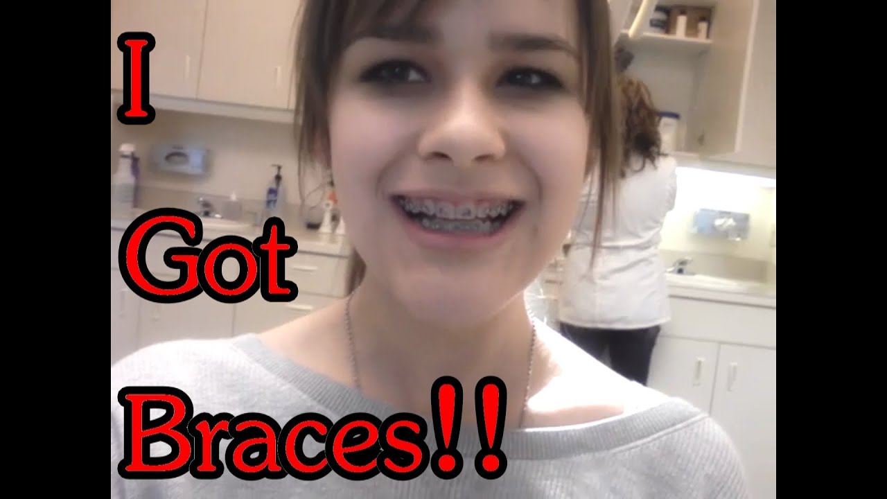 I GOT BRACES!!! (Vlog Days 310-321) - YouTube
