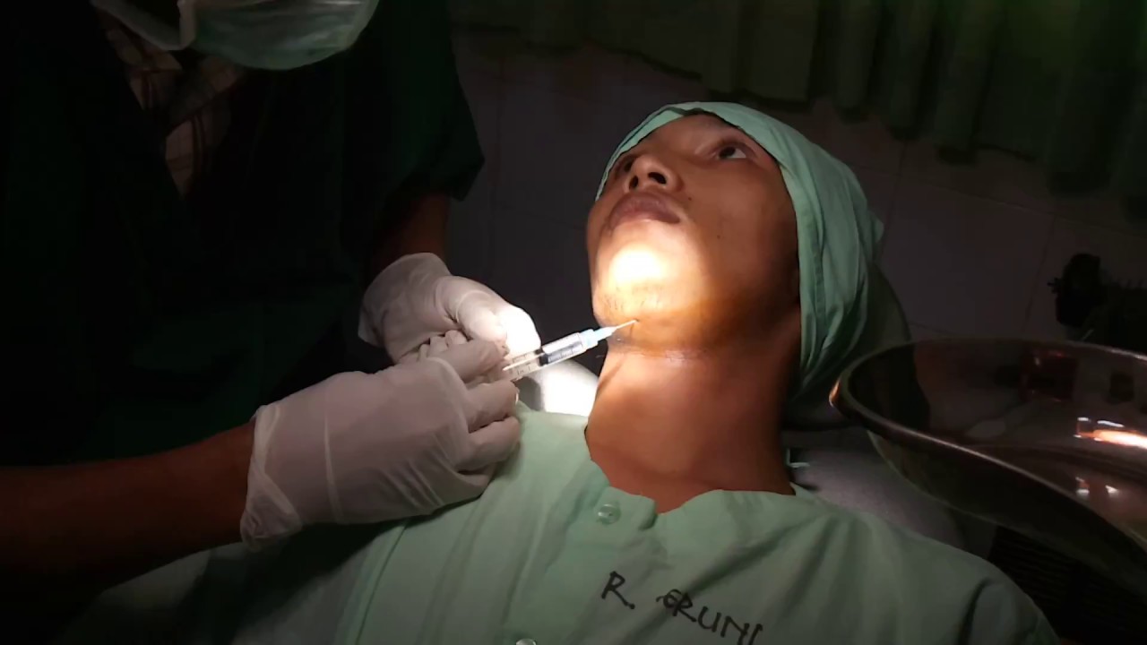 Drainase Abccess Mandibula (Abses mandibula) - YouTube