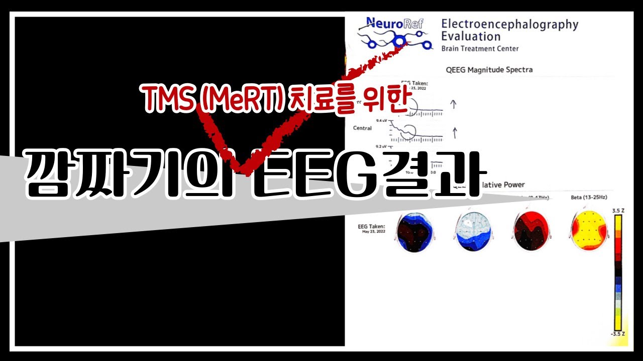 MeRT (TMS) 치료를 위한 EEG 검사 결과 들으러 의사 만나러 간 날! - YouTube