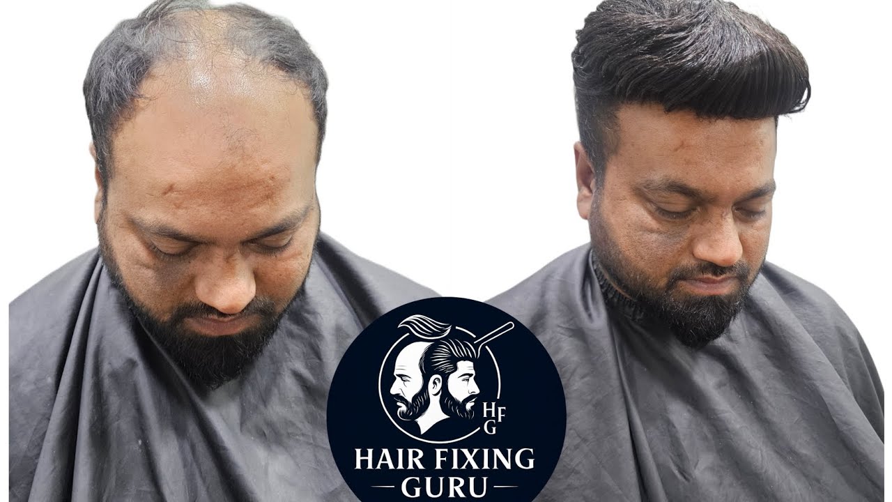 Hair patch in clipping method #hairpatch #hairstyle #wigs # ...
