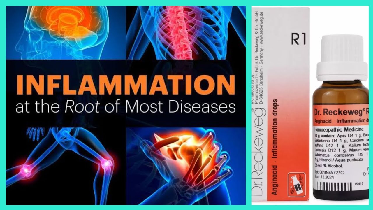 dr reckeweg r1 | r1 for inflammation | r1 benefits | dr reckeweg r1 ...
