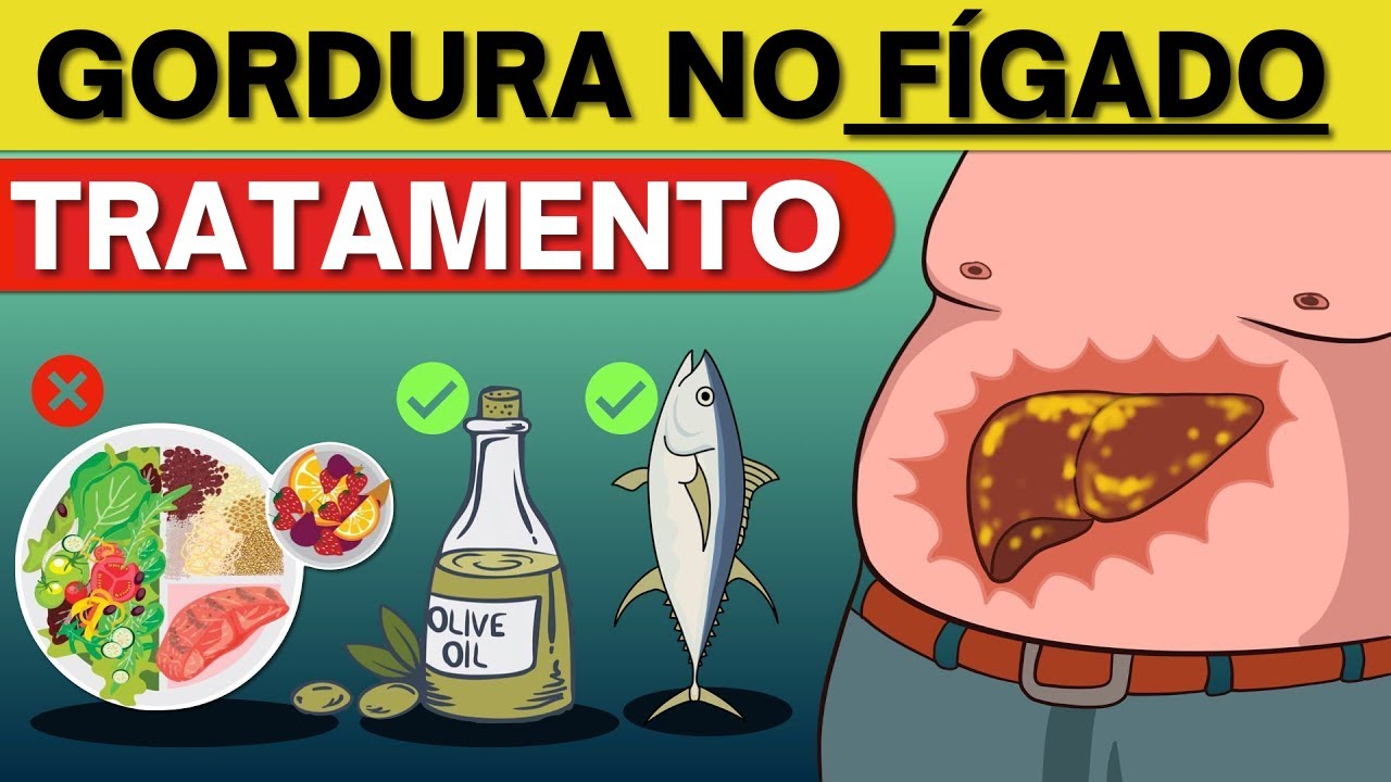 Como ELIMINAR, REDUZIR e TRATAR a gordura no fígado RÁPIDO (Os 8 ...
