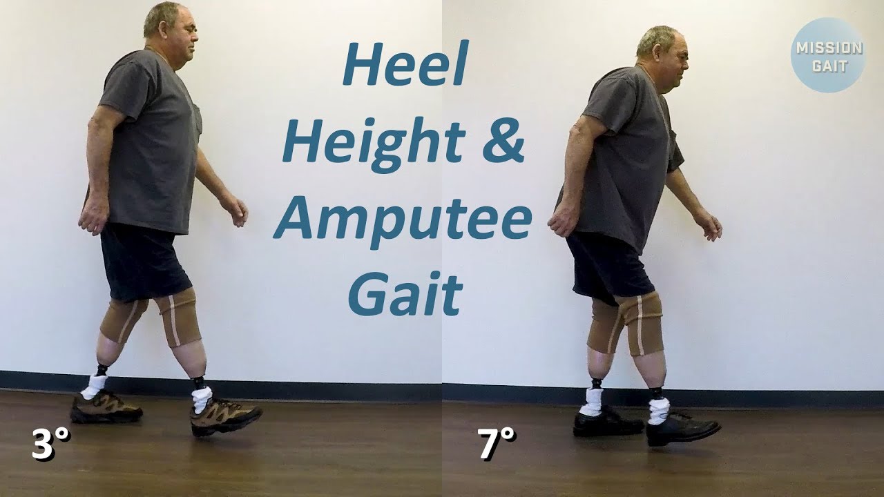 Heel Height & Amputee Gait - Case Study 9 - YouTube