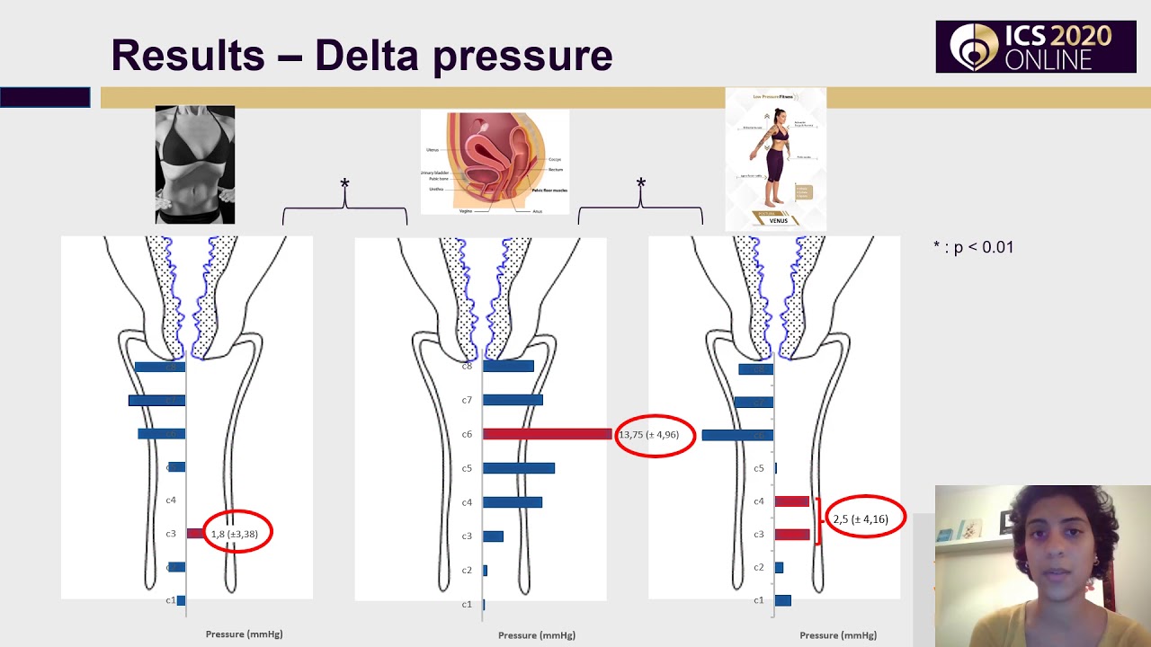ICS 2020 Abstract #522 Intravaginal pressure profile during two ...