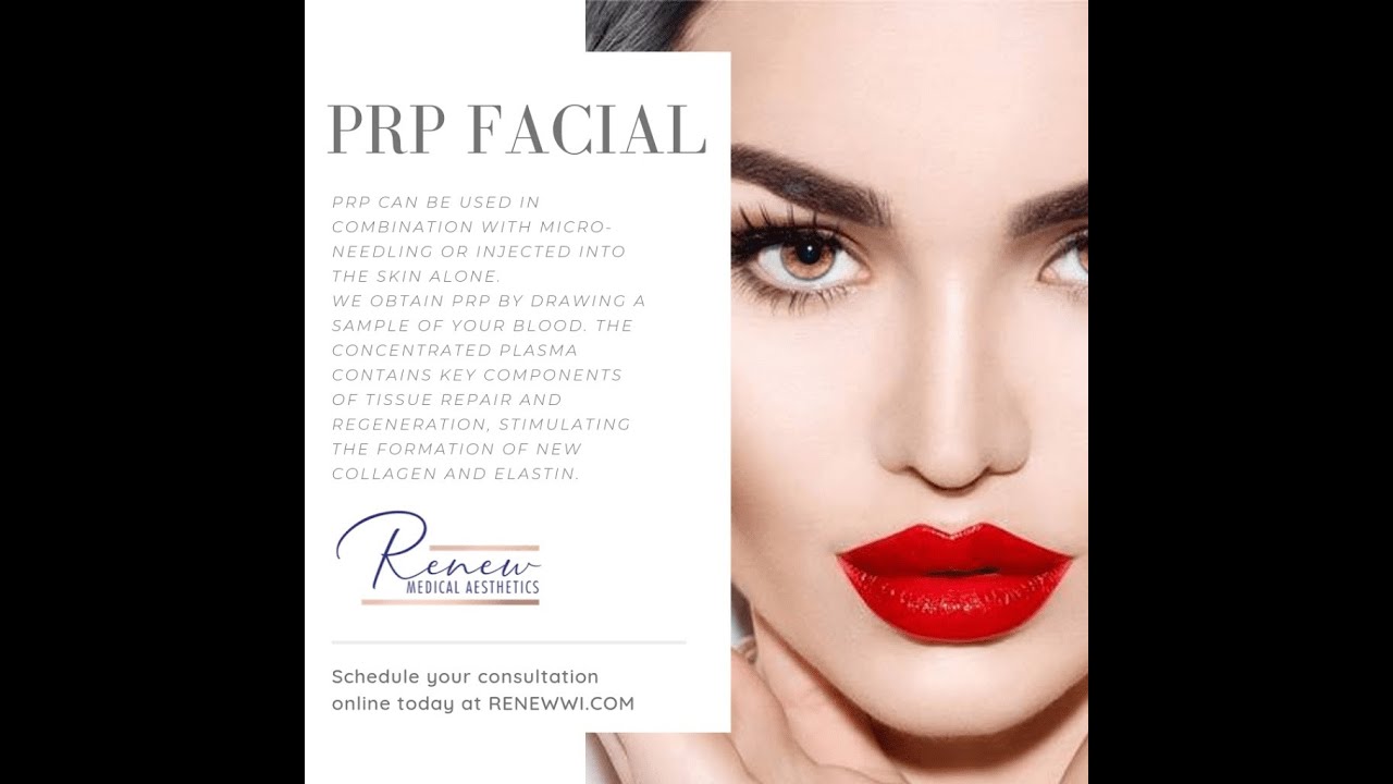 PRP | SKIN PEN | RENEW MEDICAL AESTHETICS WI - YouTube