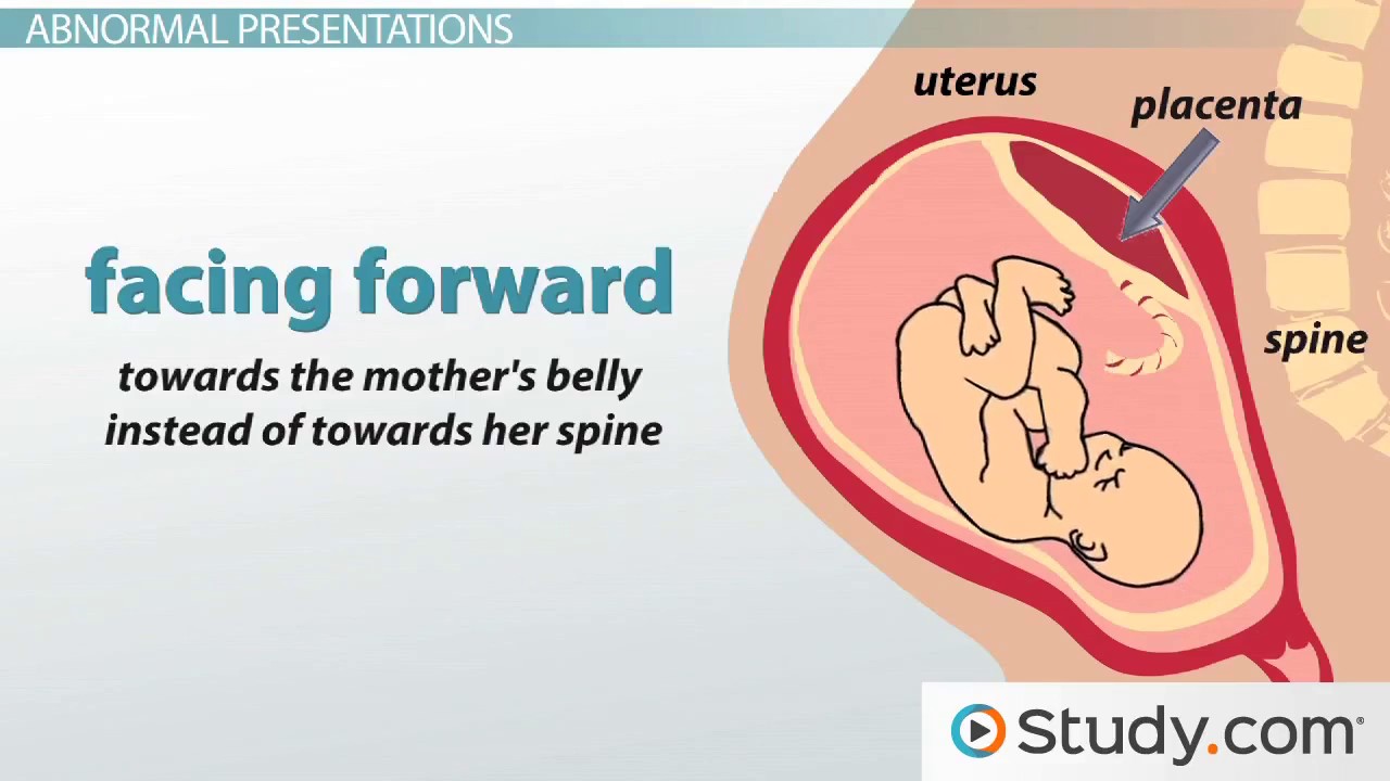 Fetal Dystocia Normal and Abnormal Fetal Positions Prior to Childbirth ...