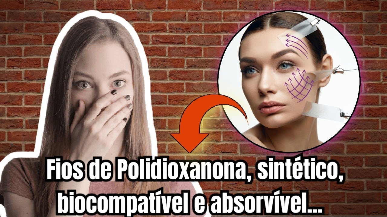 OQUE SÃO FIOS DE PDO - YouTube