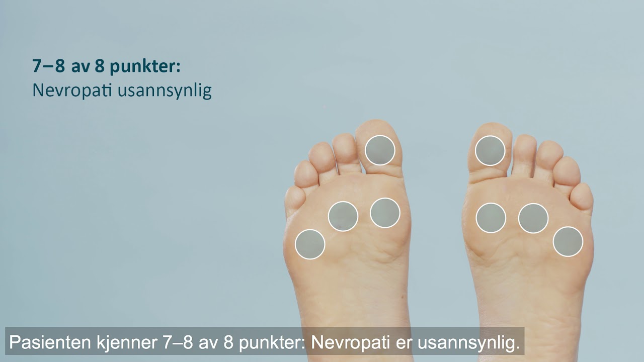 diabetes-fot-og-nevropati-3-7-youtube