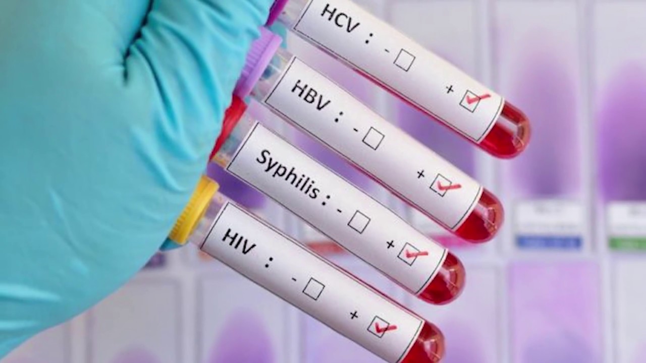 Major HIV/AIDS Infestation in US SCHOOLS, Largest Cluster Discovery, 3. ...