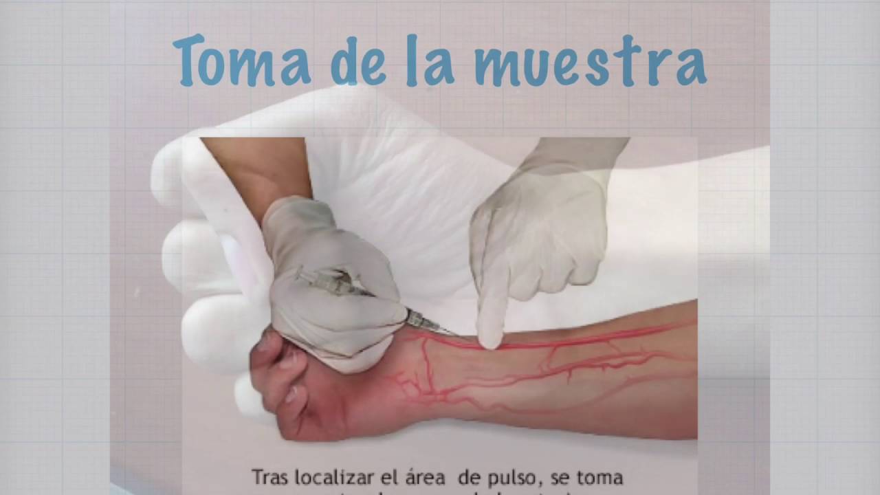 ¿Cómo se hace la Gasometría? ¡En Emergencias! - YouTube