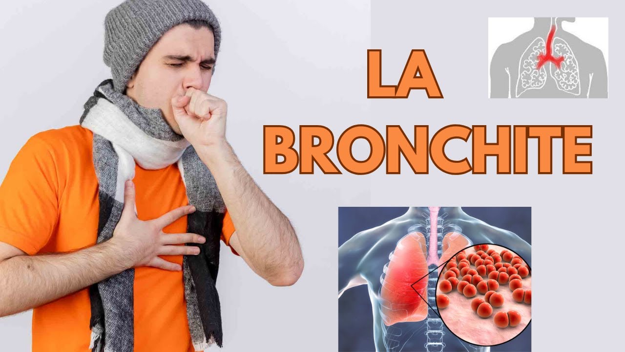 Comment guérir d'une BRONCHITE ? - YouTube