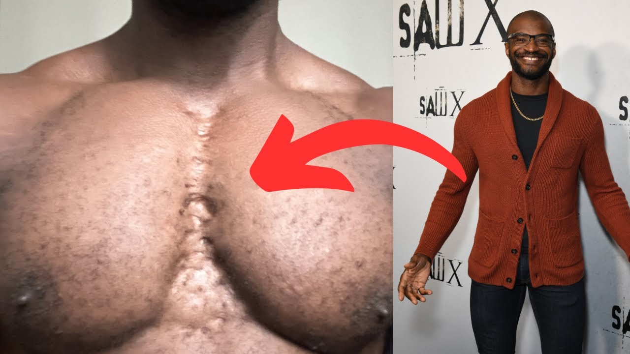 Addressing my Chest Scar | Saw X Premiere - YouTube