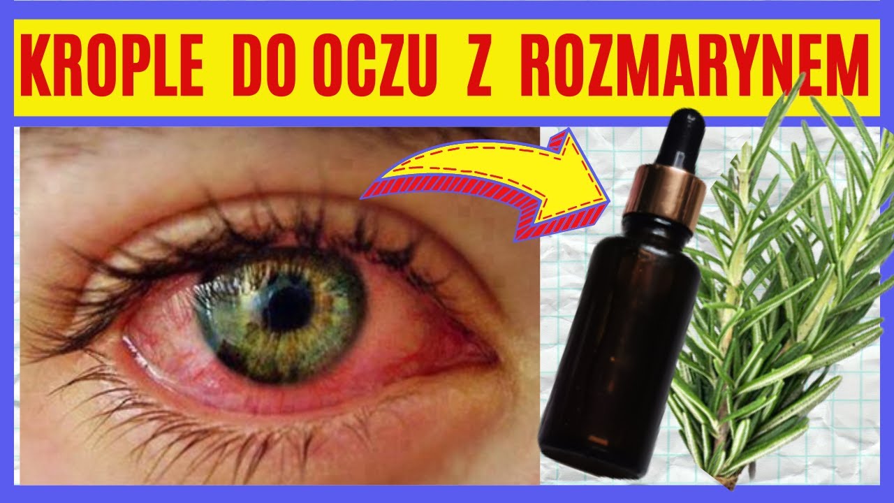 Naturalne krople do oczu z rozmarynu / Stany zapalne oka / Zaćma ...