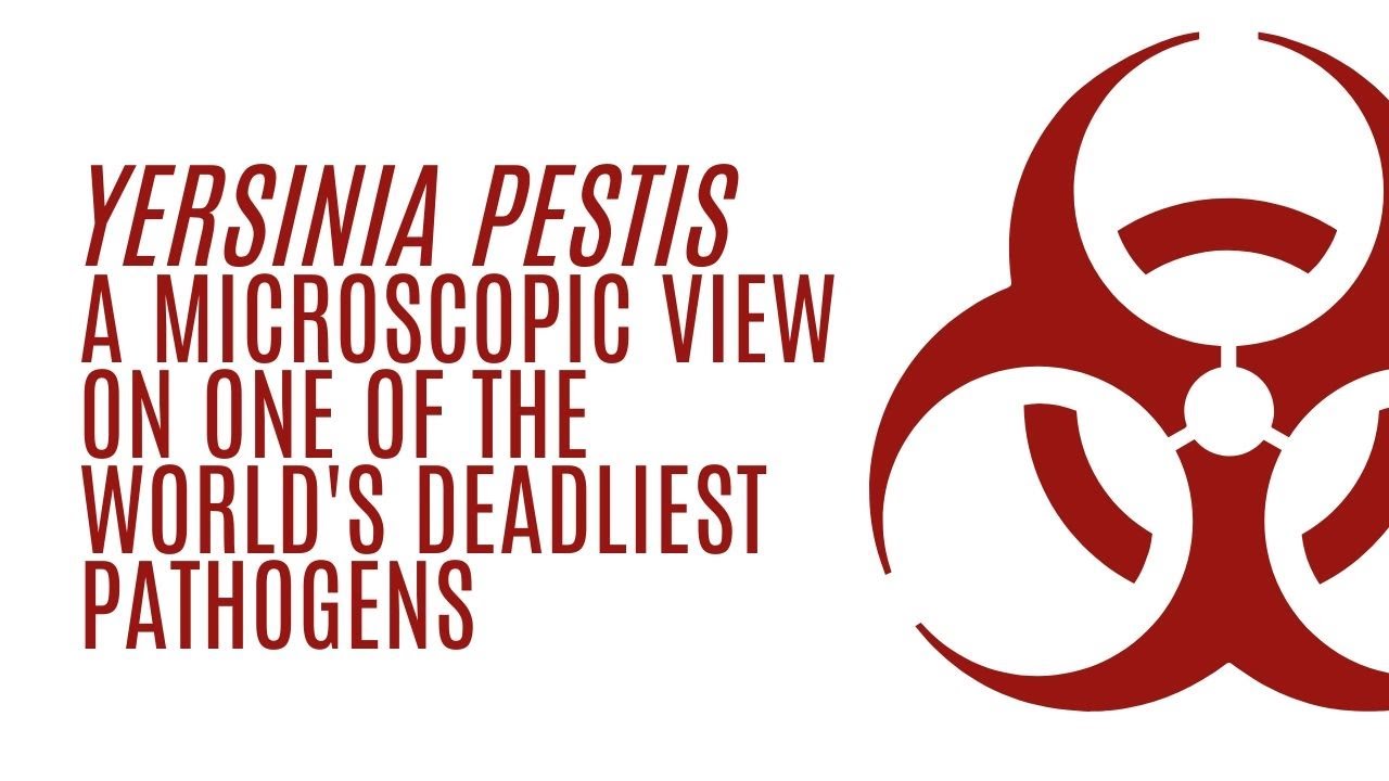 Yersinia pestis: A microscopic view on one of the world's deadliest ...