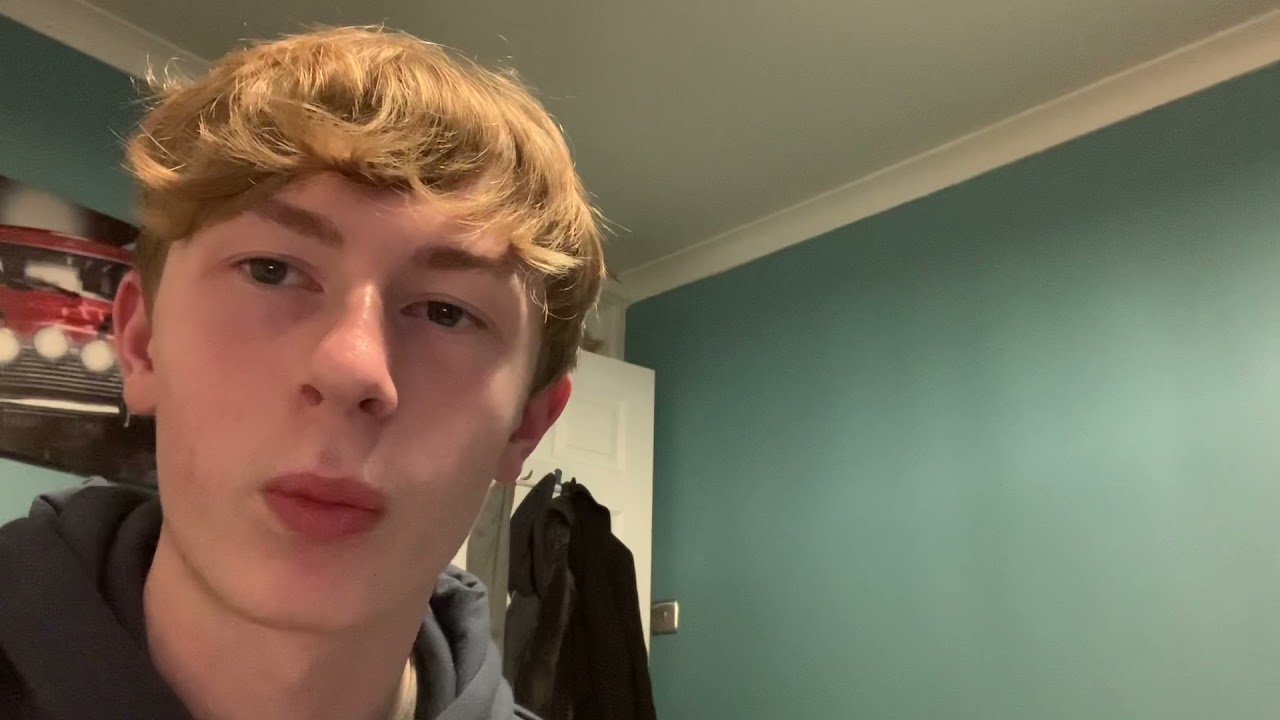 Alex Jonathan white hates his braces - YouTube