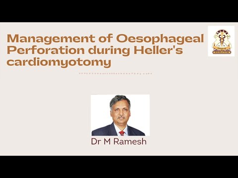 Management of Oesophageal Perforation during Heller s Cardiomyotomy ...