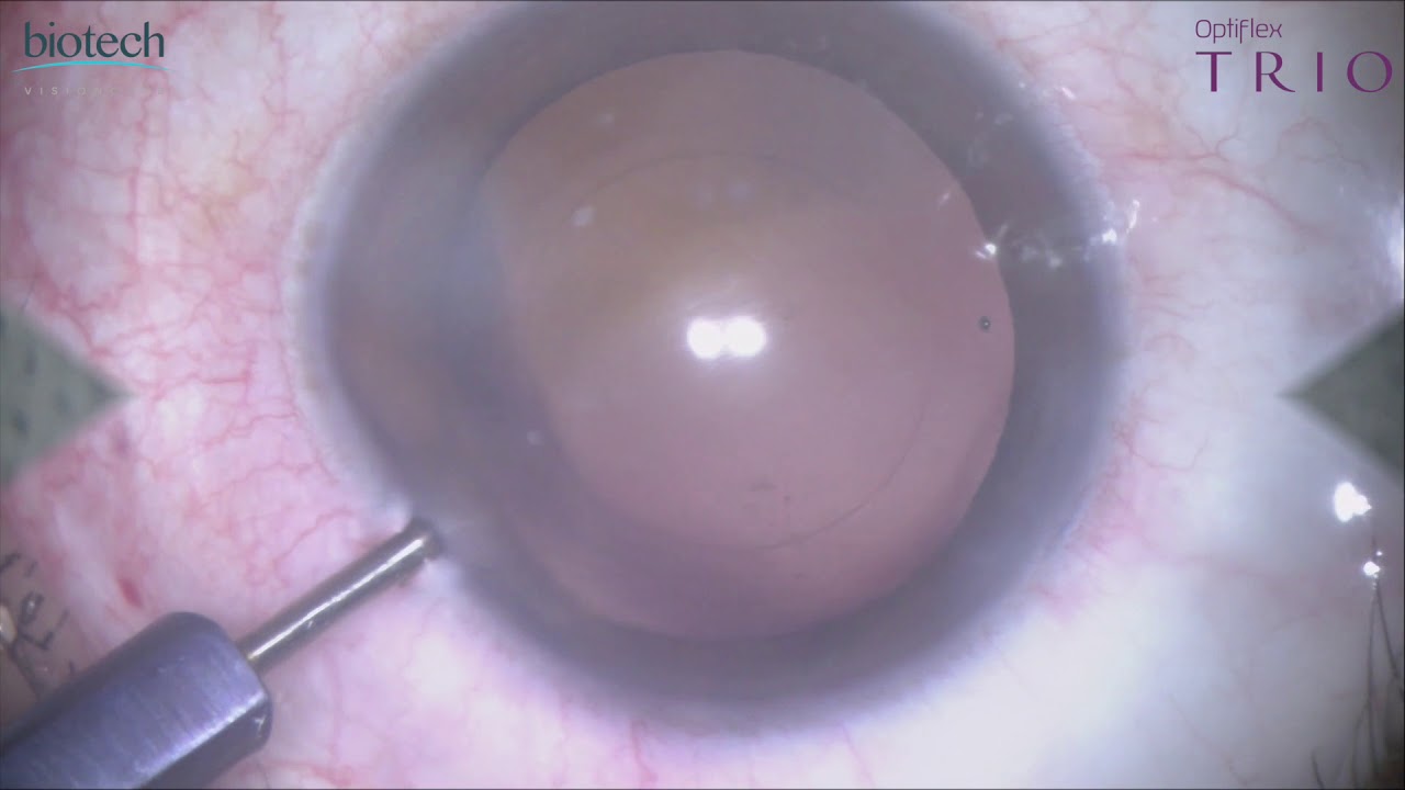 Optiflex TRIO - YouTube