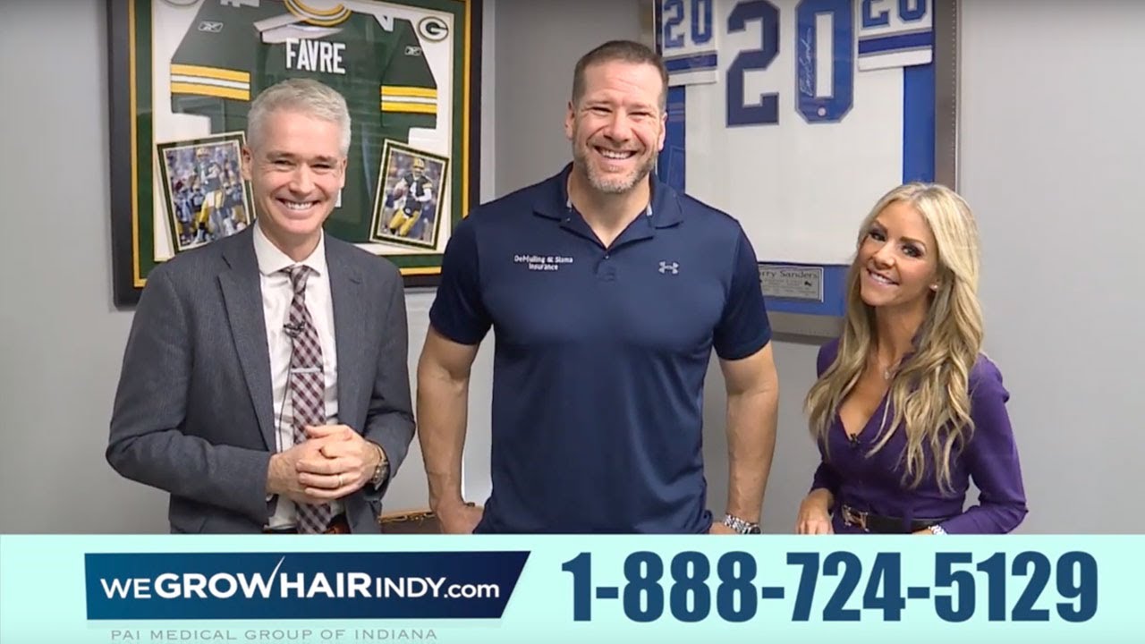 Rick DeMulling 8 Month Multi-Unit Hair Grafting™ Transplant Results ...