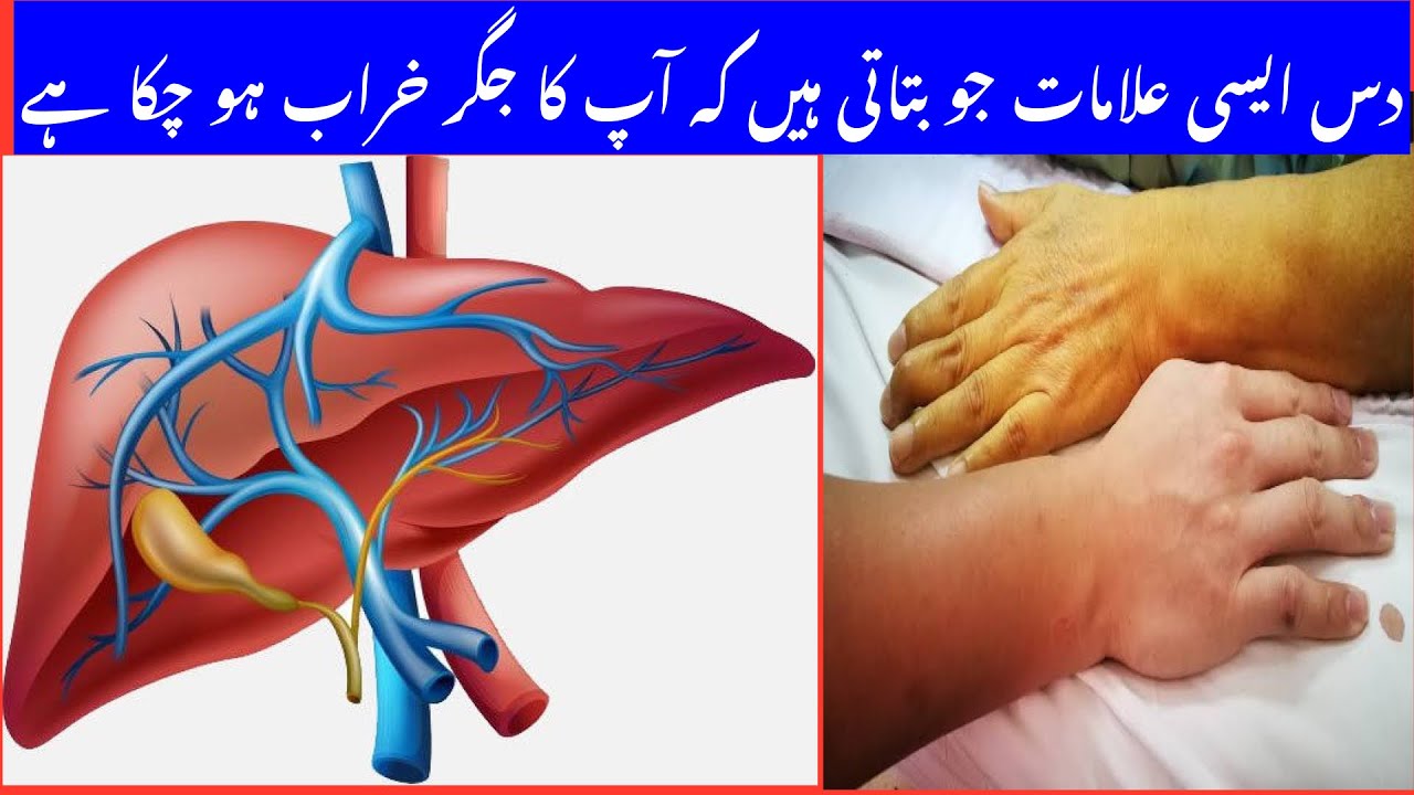 Liver functions deranged,symptoms - YouTube