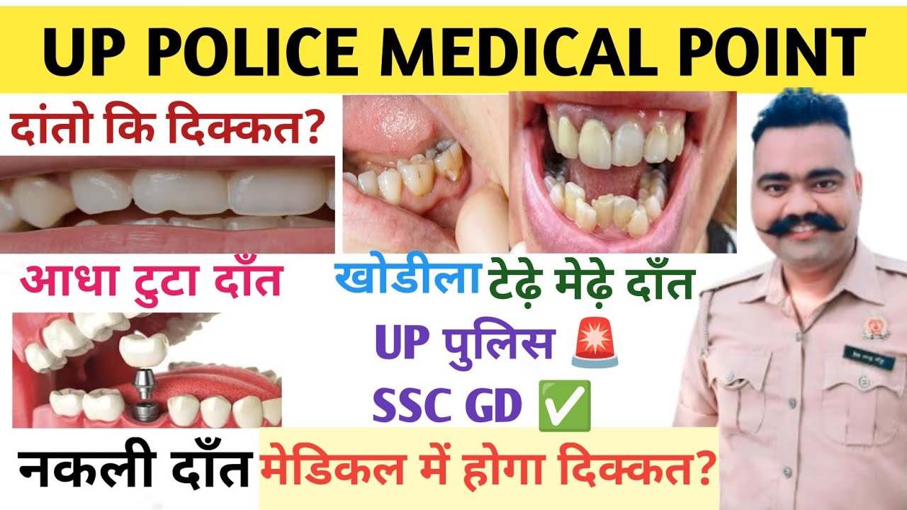 यूपी पुलिस में दांतो का मेडिकल कैसा होता है, UP POLICE TEETH MEDICAL ...