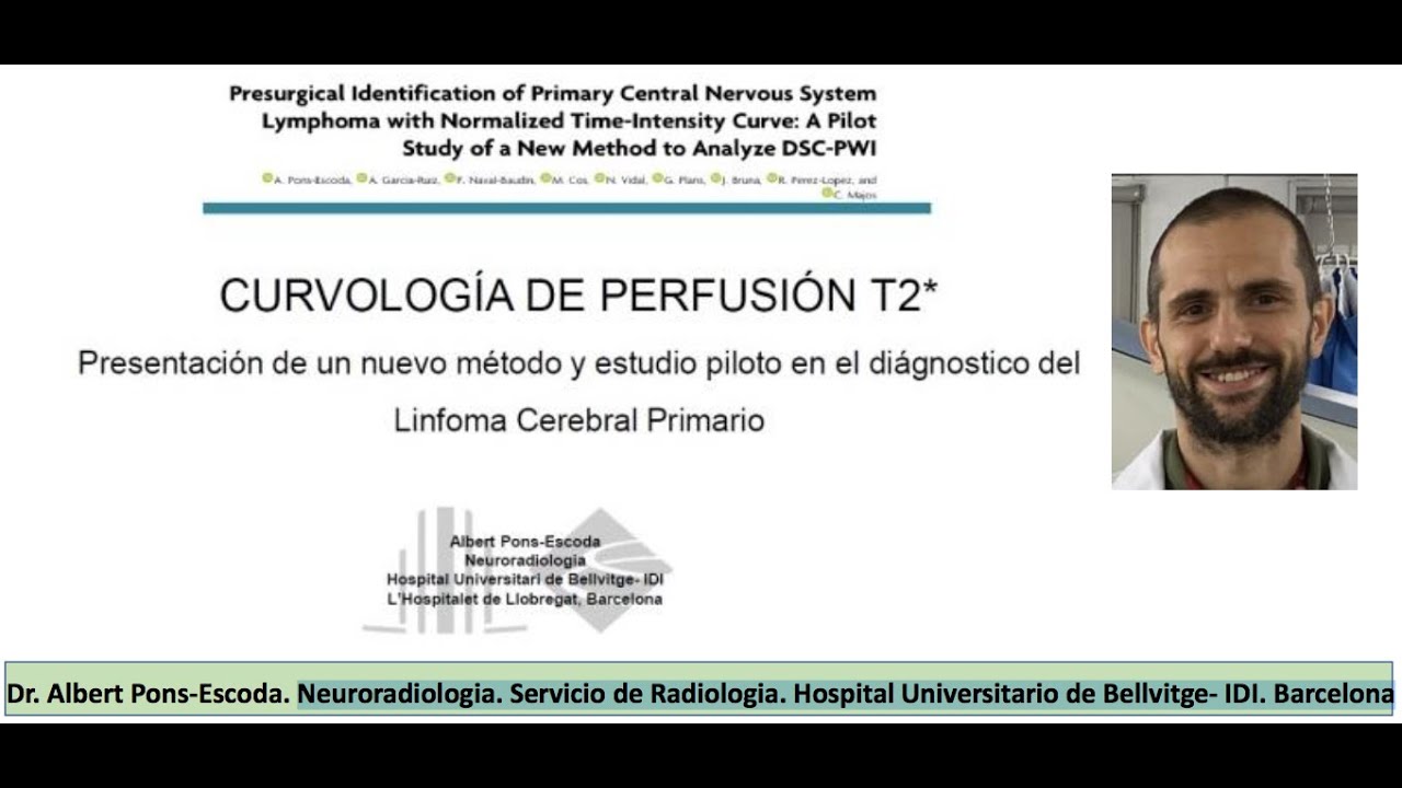 CURVOLOGIA EN PERFUSIÓN T2. LINFOMA CEREBRAL PRIMARIO. Dr. Albert Pons ...