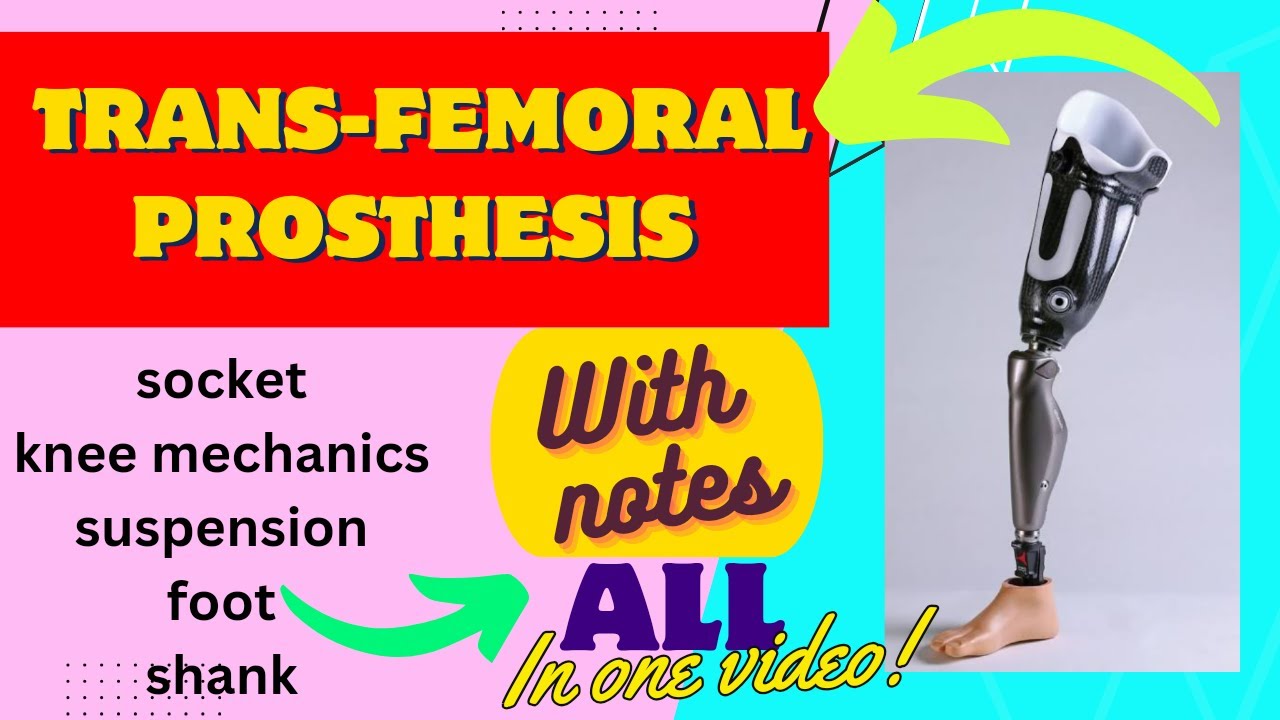 Trans-femoral prosthesis- all parts- socket, knee unit, suspension ...