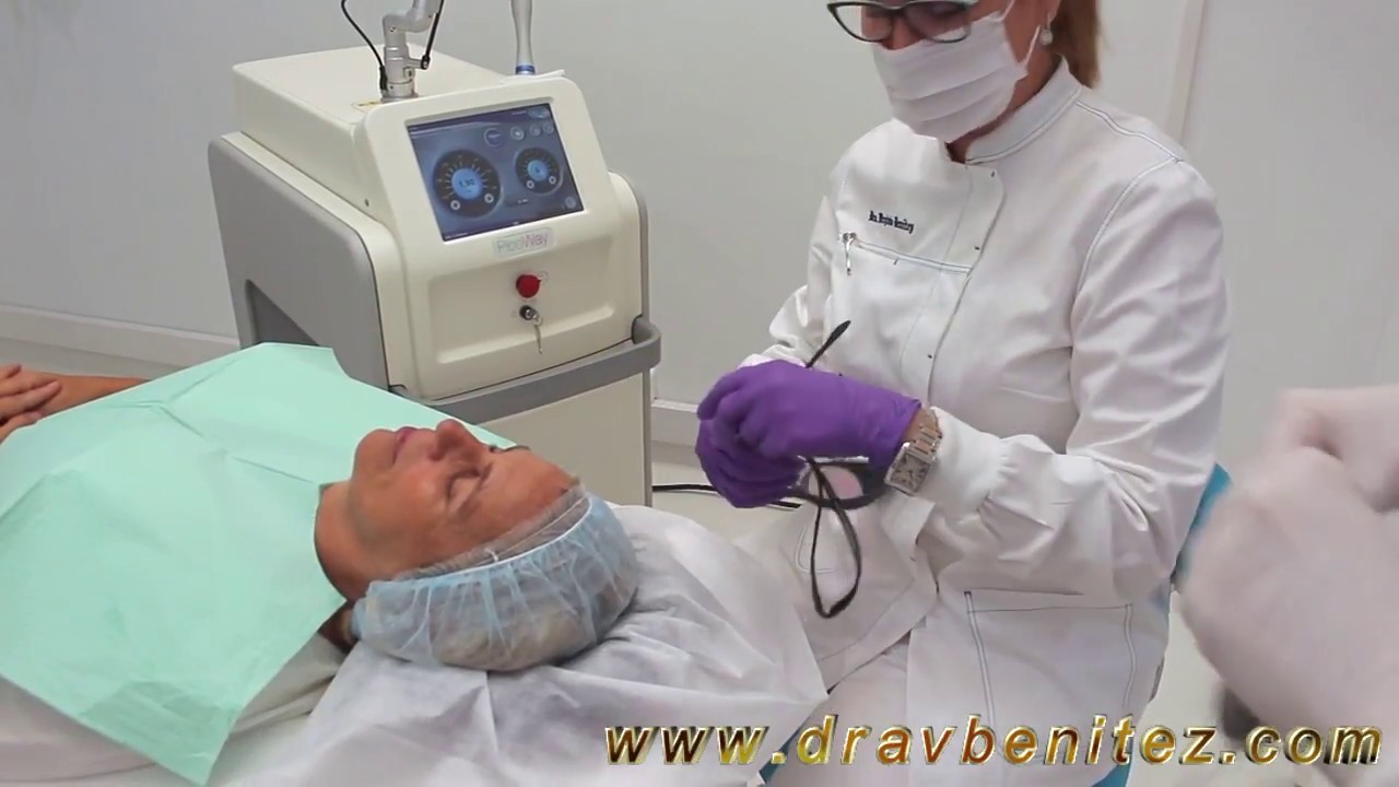 PicoWay Laser, Resolve, Holographic Fractional for Ageing Spots, Sun ...